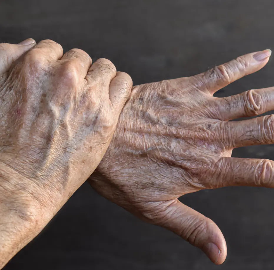 What Works: Removing Age Spots from Hands During Menopause - A Genova ...